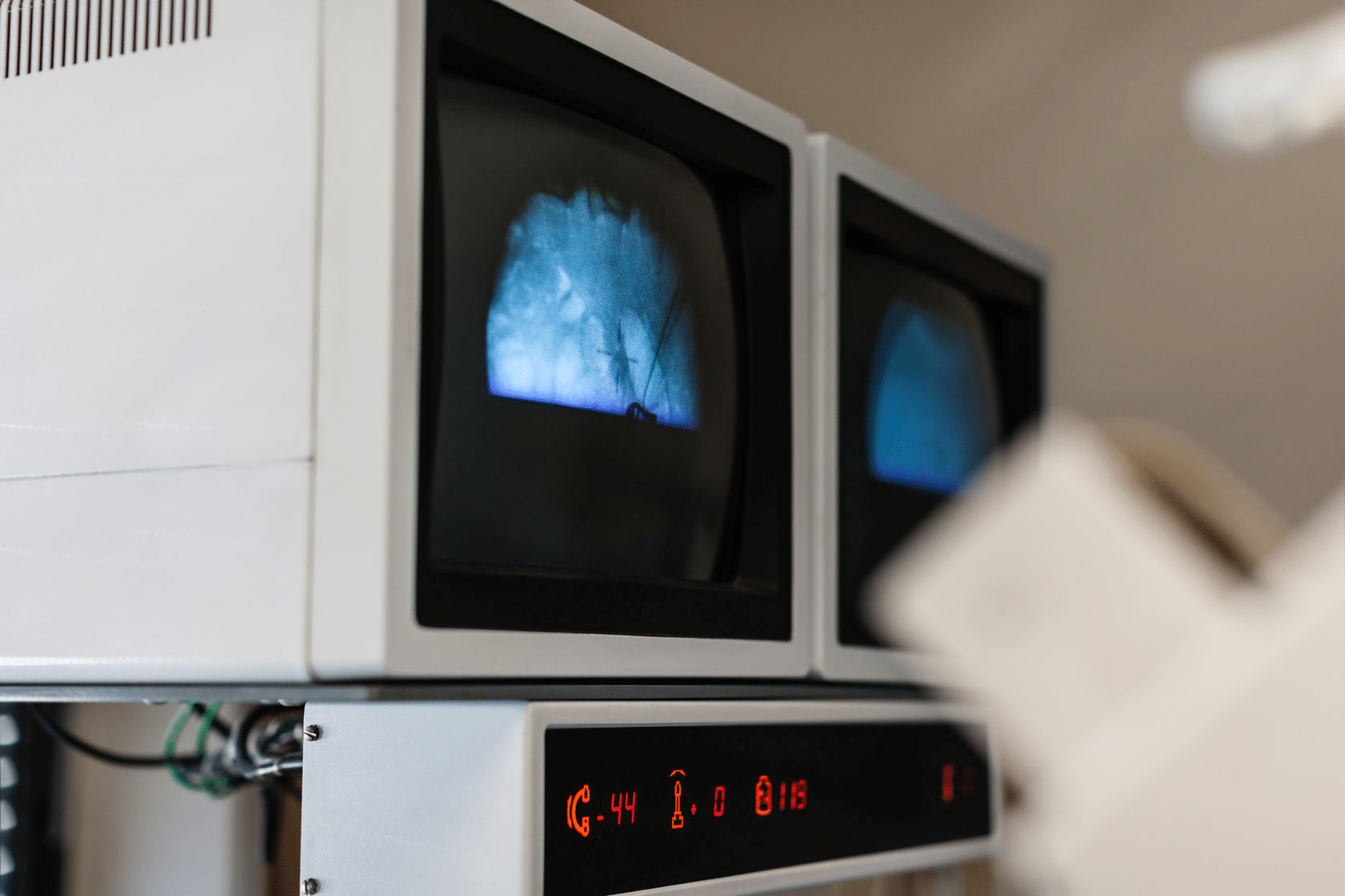 Fluoroscopy: Real-time X-ray Imaging in Medicine