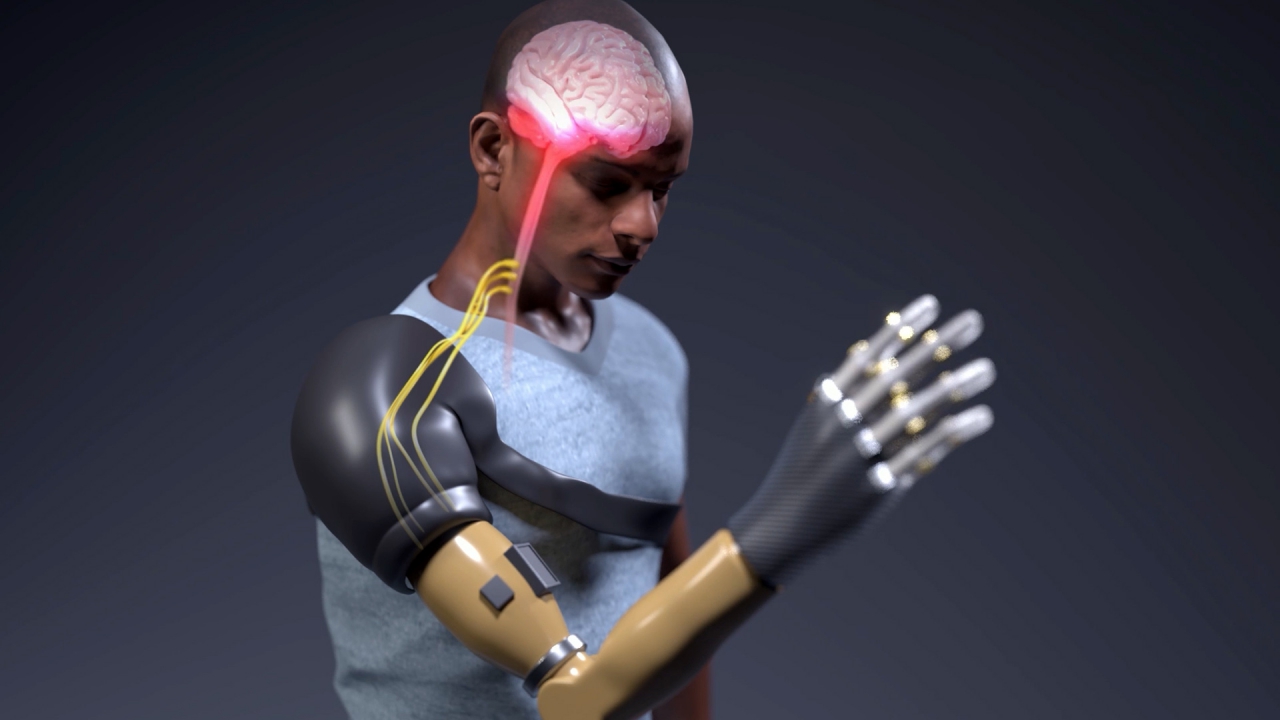 Biomechanics and the Role of AI in Prosthetic Design