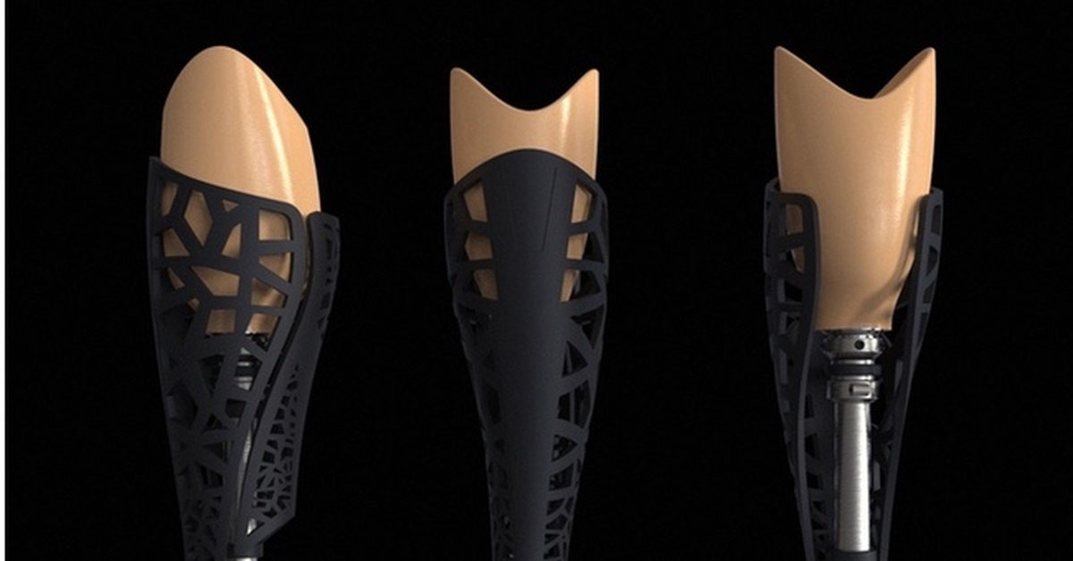 Biomechanics and the Role of AI in Prosthetic Design