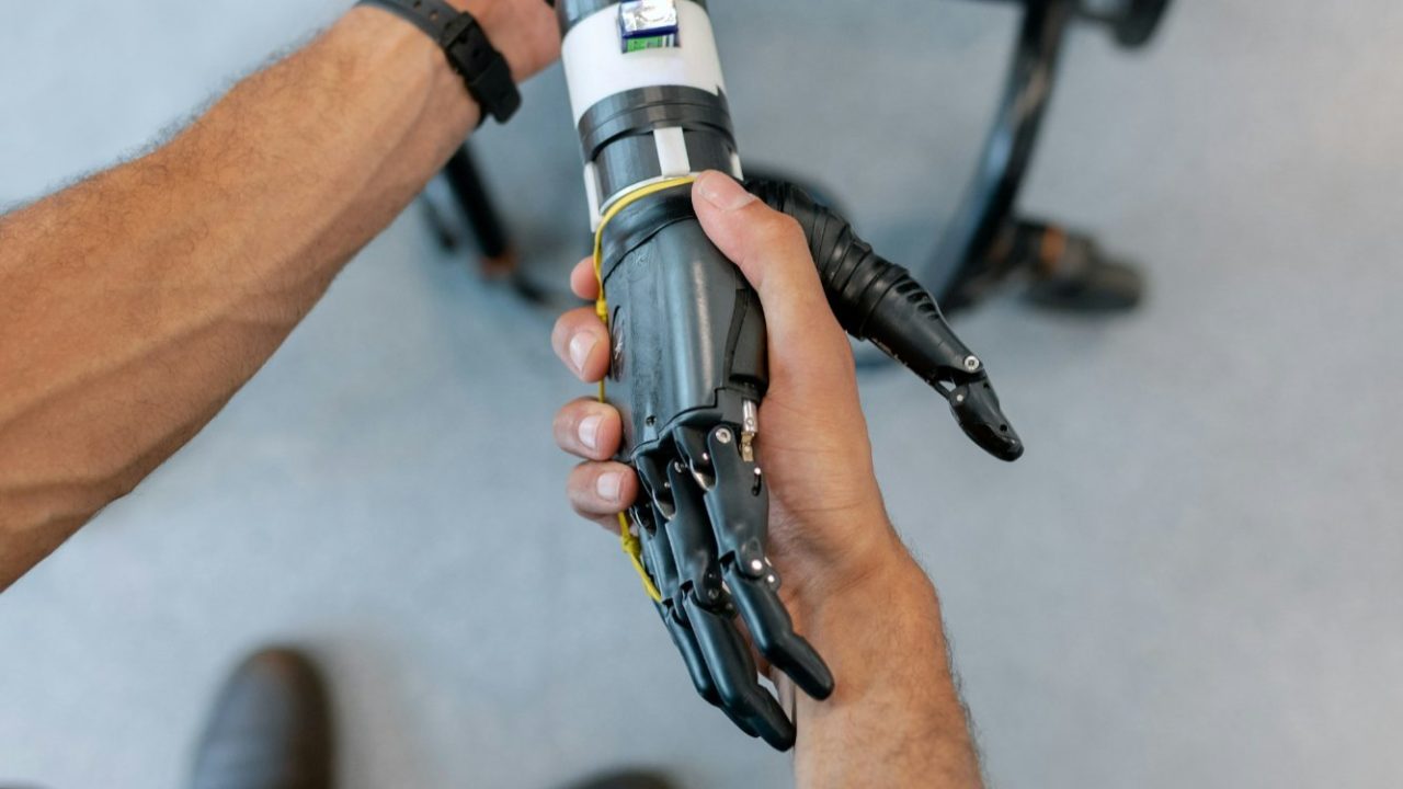 The Role of AI in the Development of Smart Prosthetics and the ...